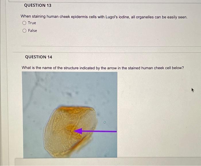 Solved When focusing a slide on a compound microscope, an | Chegg.com