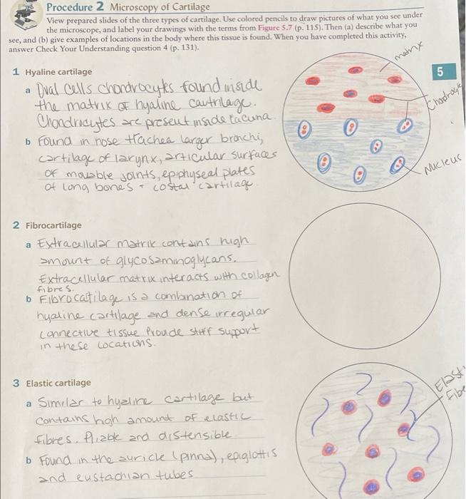 Solved Procedure 2 Microscopy of Cartilage View prepared | Chegg.com
