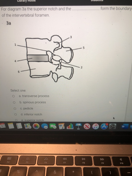 Solved form the boundary For diagram 3a the superior notch | Chegg.com