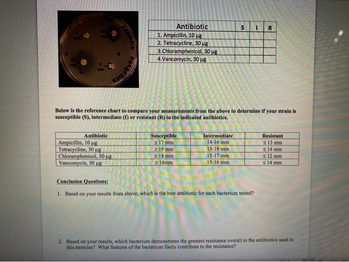 Solved After reviewing the Lab Module 6- Kirby-Bauer | Chegg.com