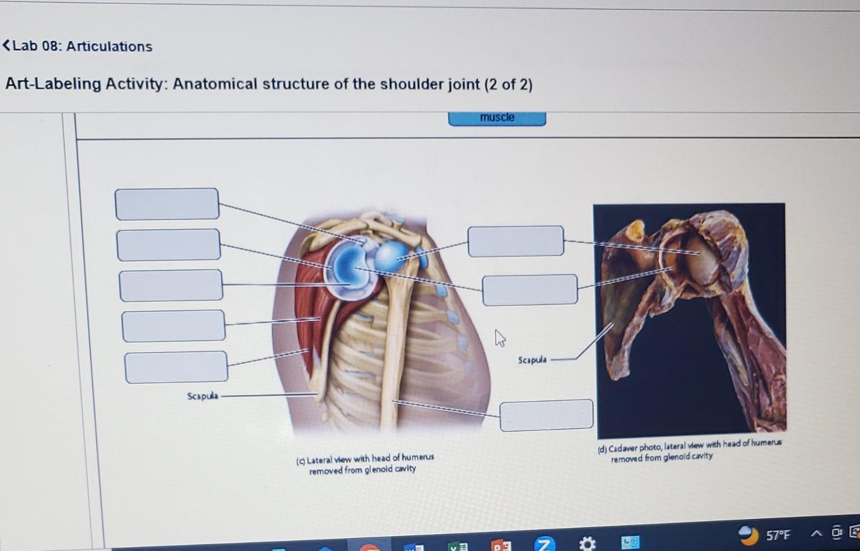 Solved Art-Labeling Activity: Anatomical structure of the | Chegg.com