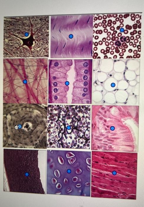 Solved please help me identufy the tissues. | Chegg.com