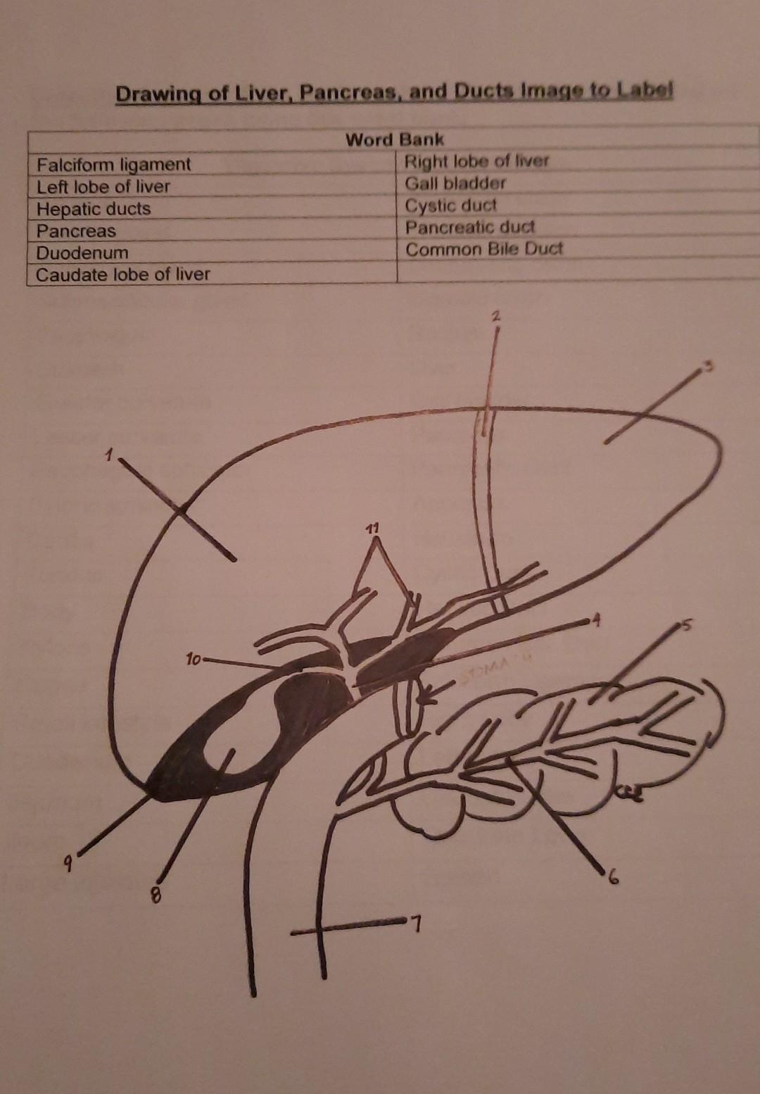 Solved Drawing of Liver, Pancreas, and Ducts image to | Chegg.com