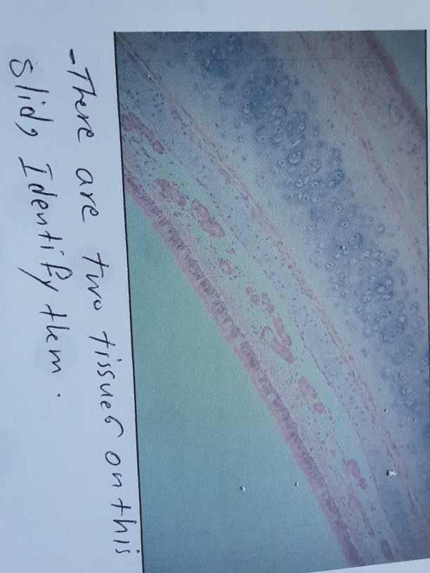 Solved Swan - There are two tissues on this slide Identify | Chegg.com