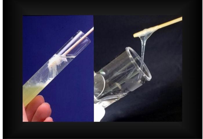 Solved Activity 5: Purification of DNA from Cheek Cells The | Chegg.com