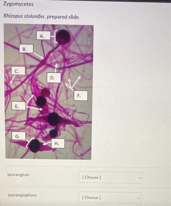 Rhizopus Conjugation Slide