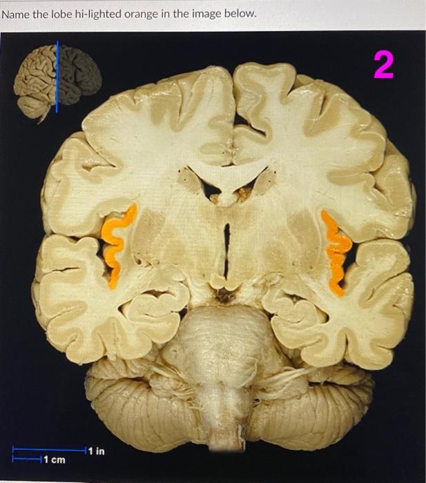 Solved Name the lobe hi-lighted orange in the image below. 1 | Chegg.com