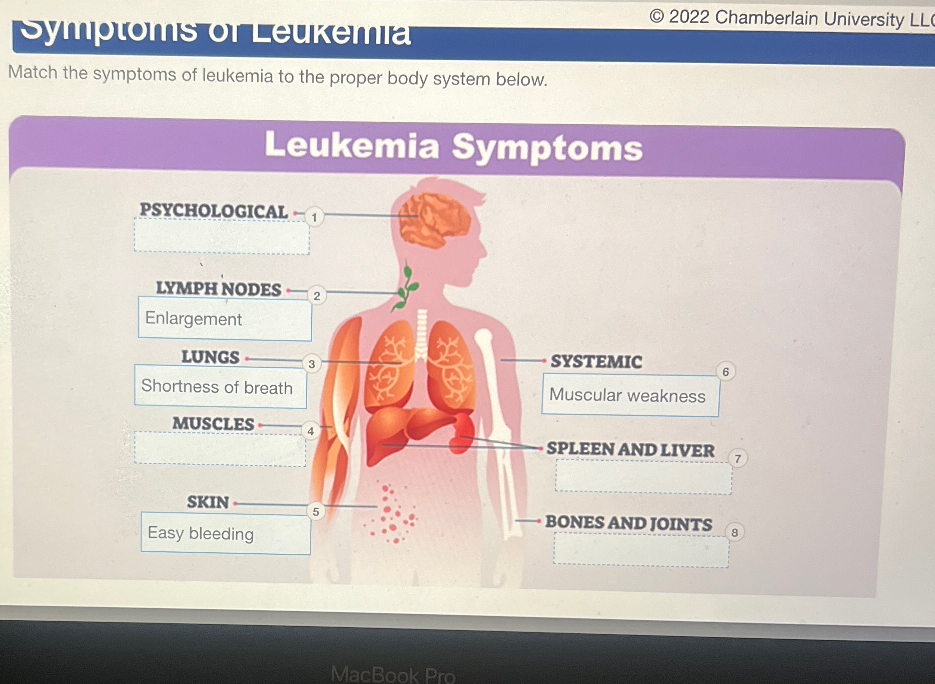 Solved Symploms or LEUkemıa(C) 2022 ﻿Chamberlain | Chegg.com