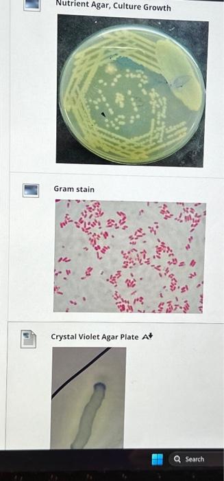 Solved Nutrient Agar, Culture Growth Gram stain Crystal | Chegg.com