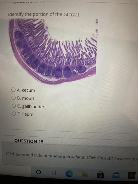 Solved Identify the portion of the GI tract: O A. cecum OB. | Chegg.com