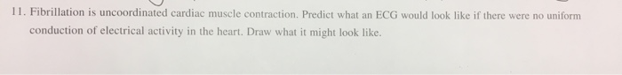 Solved 11. Fibrillation is uncoordinated cardiac muscle | Chegg.com