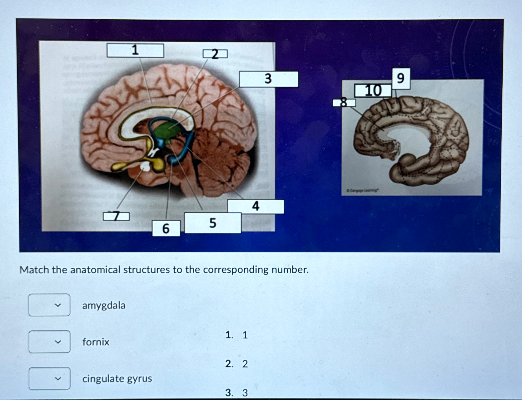 Solved Match the anatomical structures to the corresponding | Chegg.com