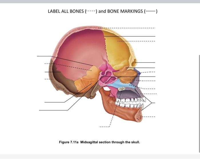 LABEL ALL BONES (−⋯) and BONE MARKINGS (-) Figure | Chegg.com
