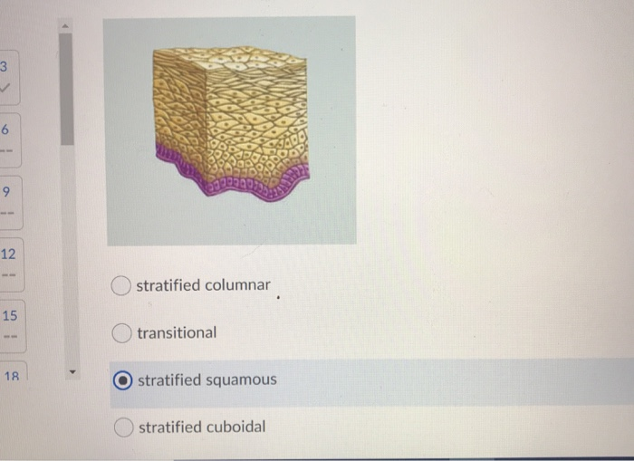 Solved 3 6 9 12 - stratified columnar 15 transitional 18 | Chegg.com