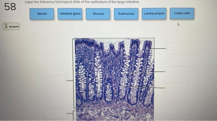 Solved Label the following histological slide of the | Chegg.com