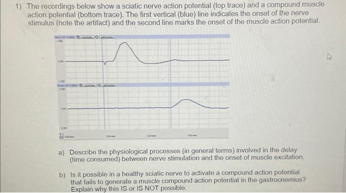 Solved 1) The recordings below show a sciatic nerve action | Chegg.com