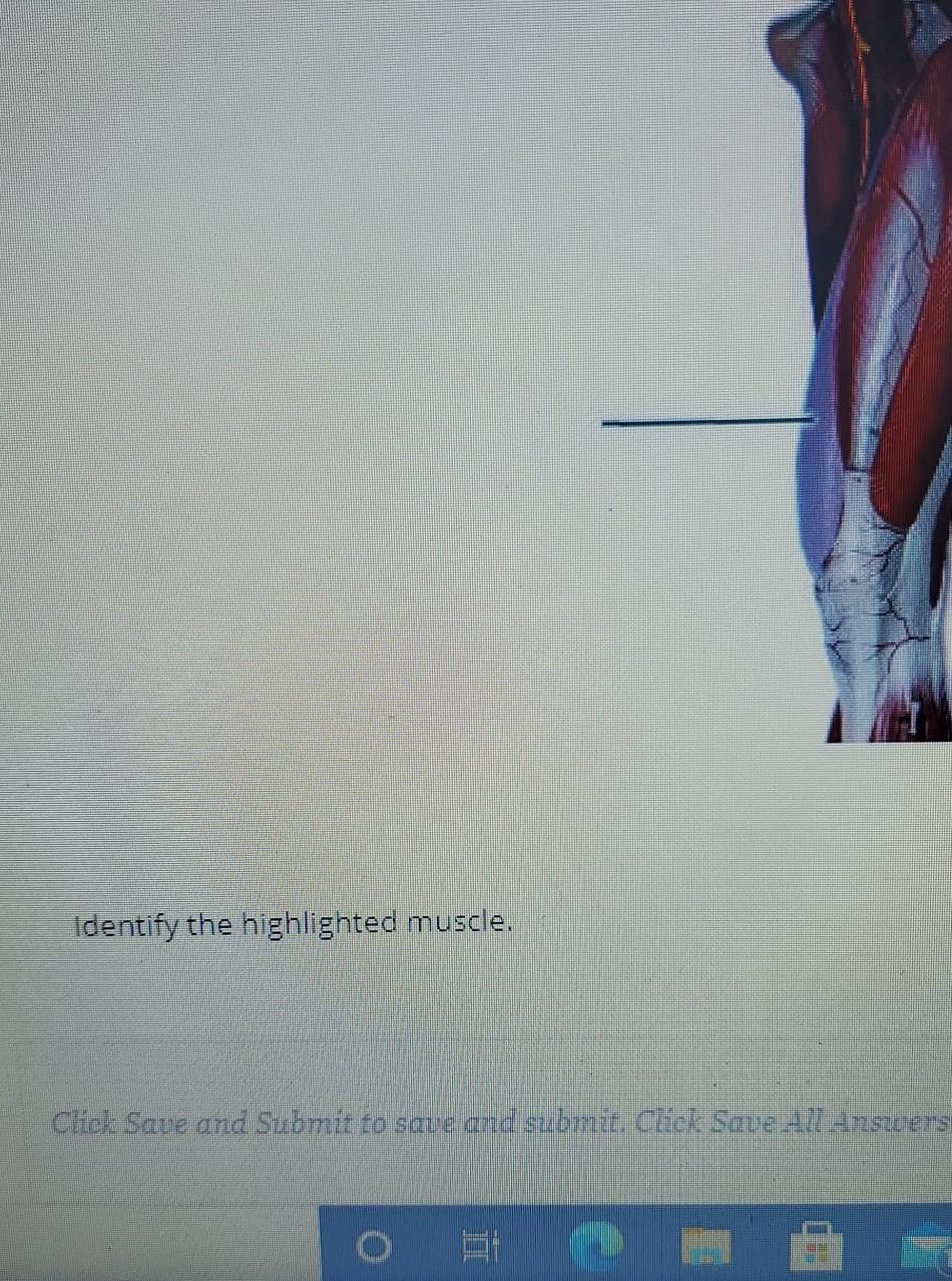 Solved Identify the highlighted muscle. Click Save and | Chegg.com