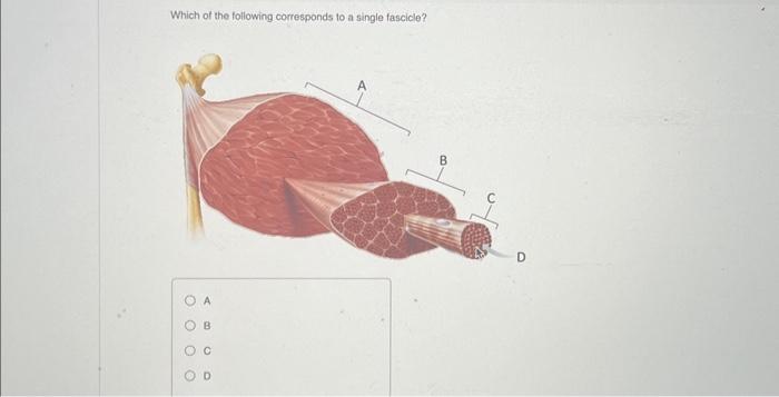 Solved Which of the following corresponds to a single | Chegg.com
