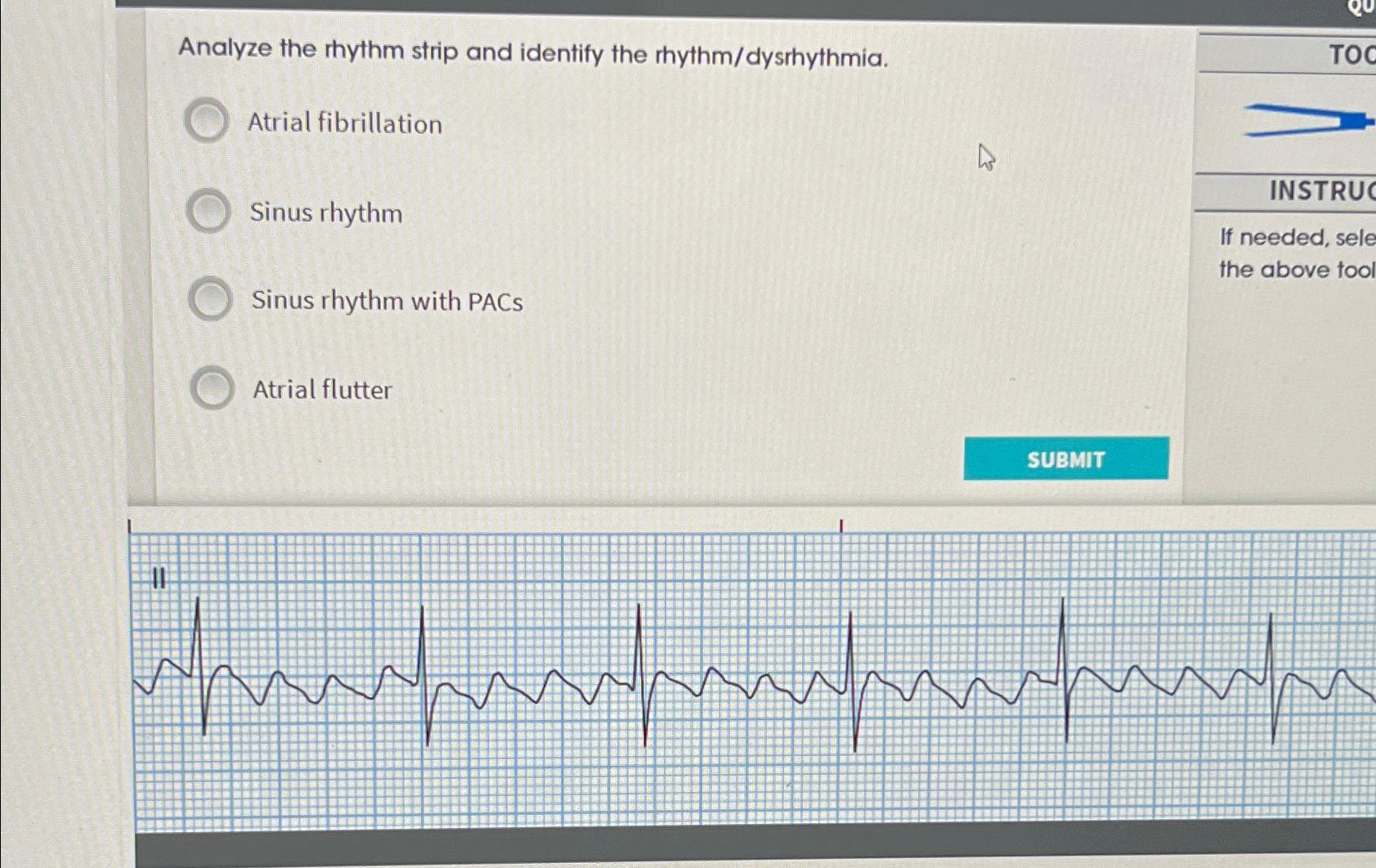Solved Analyze the rhythm strip and identify the | Chegg.com