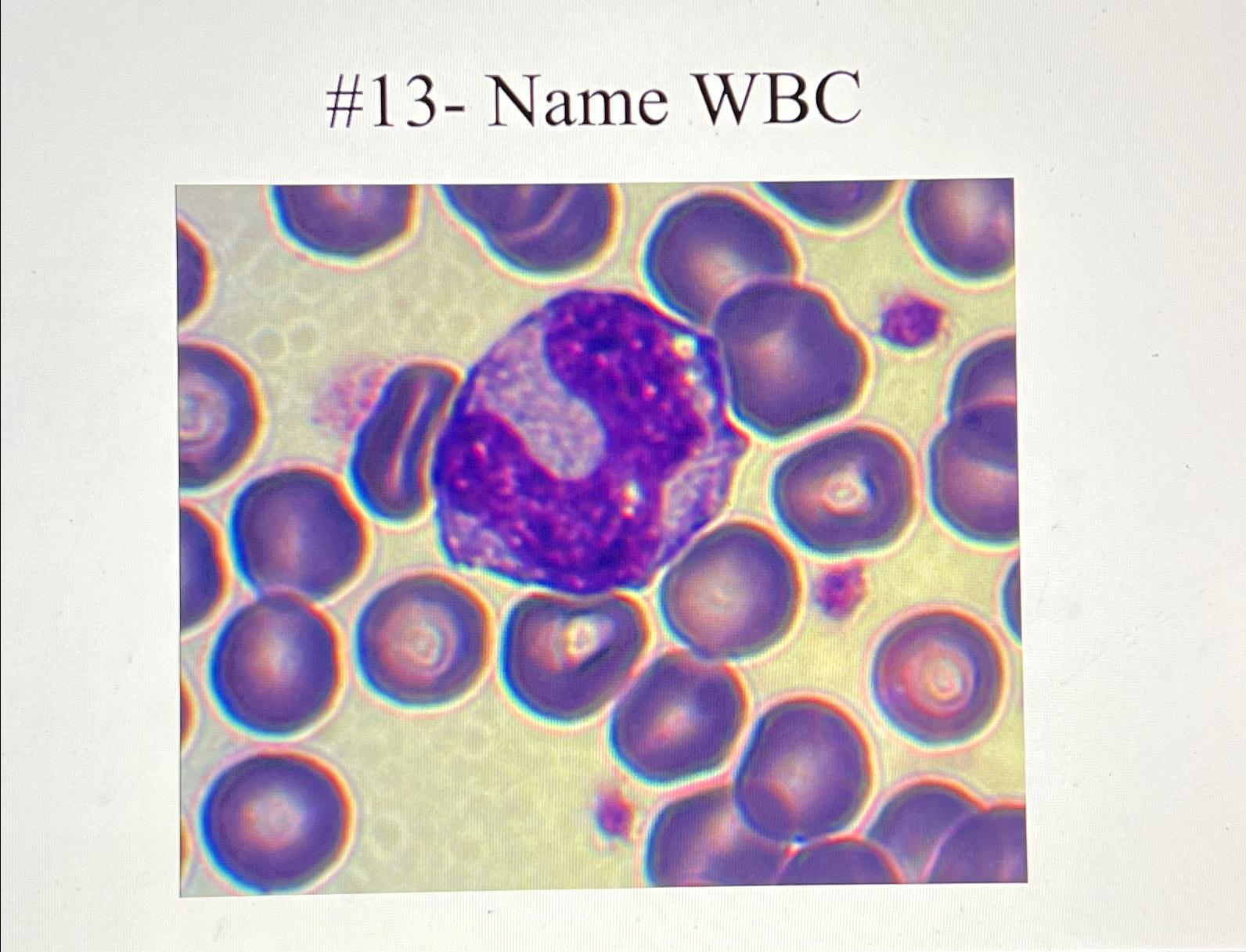Solved #13- ﻿Name WBC | Chegg.com