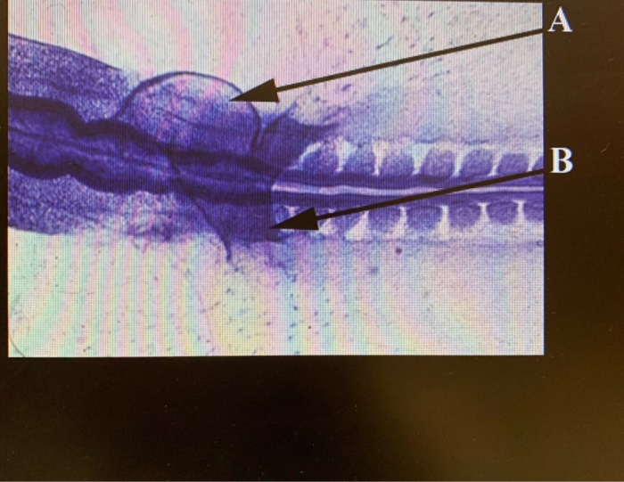Solved 5A. Identify the structure at the end of the pointer | Chegg.com