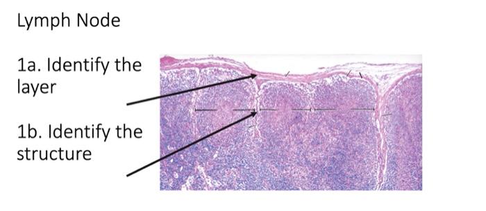 Solved Lymph Node 1a. Identify the layer 1b. Identify the | Chegg.com