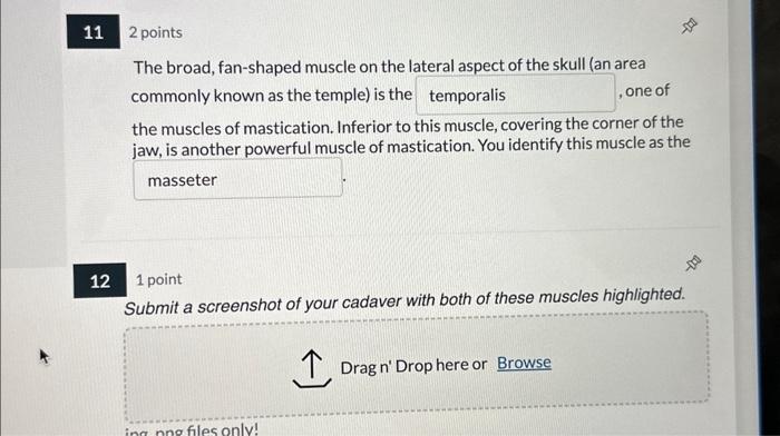 Solved 2 points The broad, fan-shaped muscle on the lateral | Chegg.com