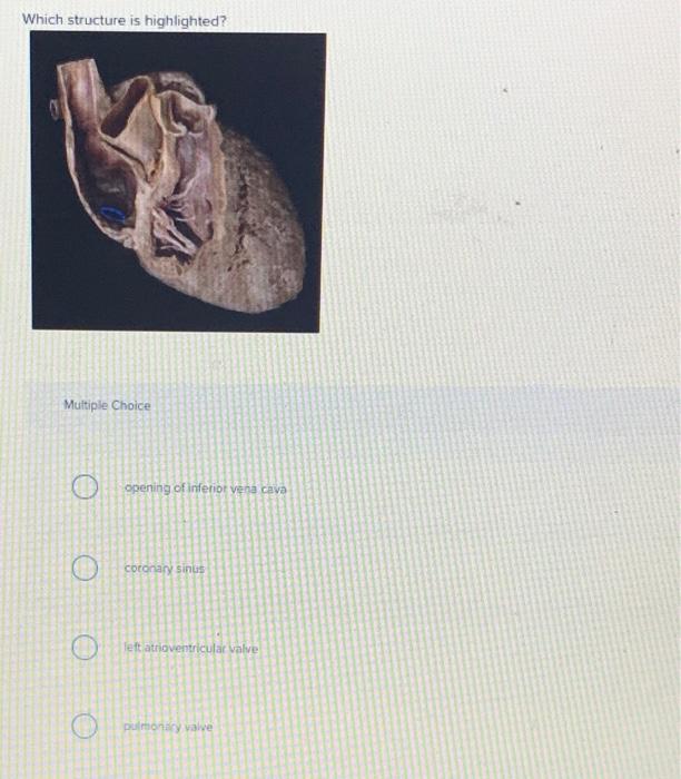 Solved Which structure is highlighted? Multiple Choice night | Chegg.com