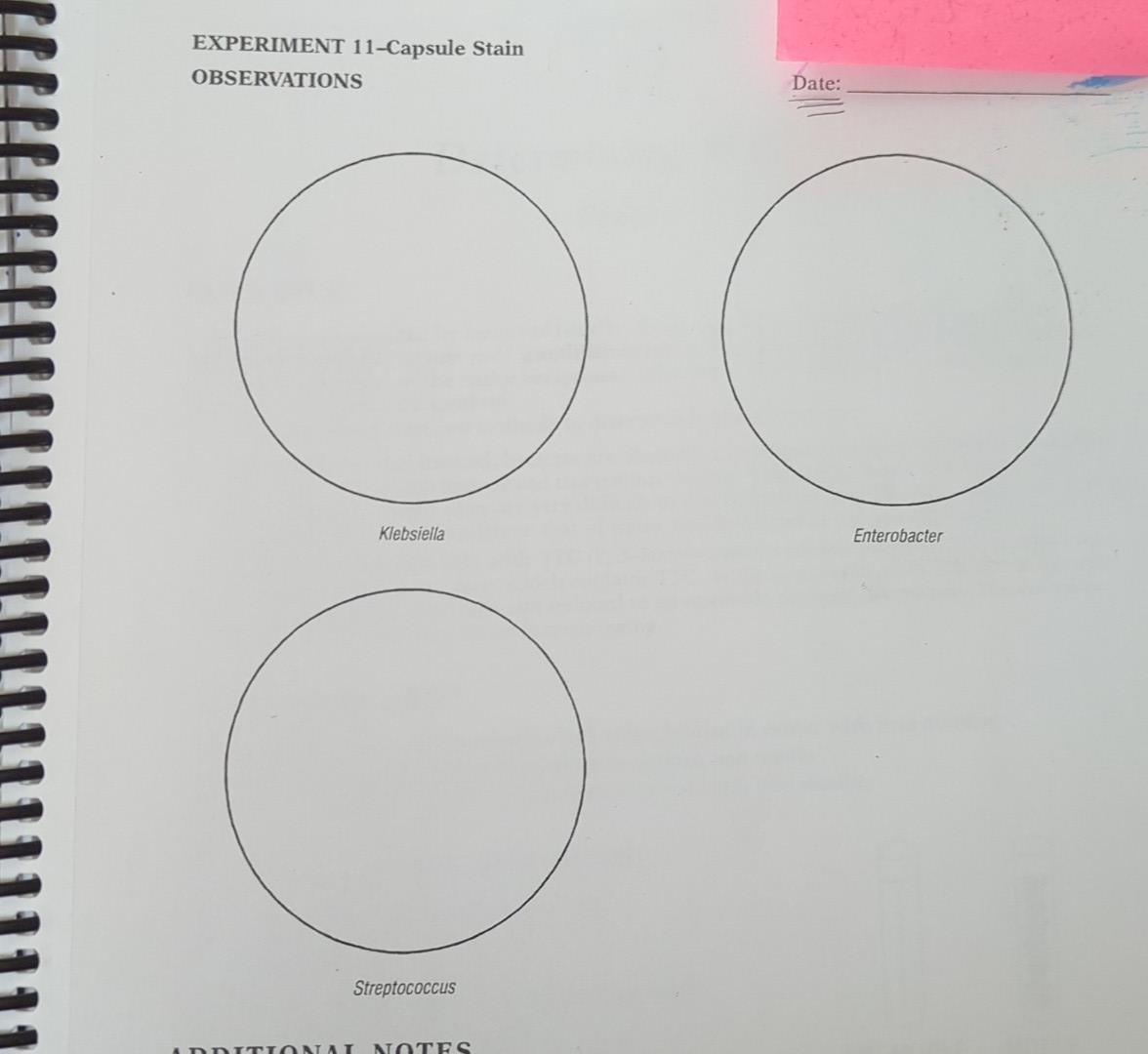 EXPERIMENT 11-Capsule Stain OBSERVATIONS nevsicild | Chegg.com