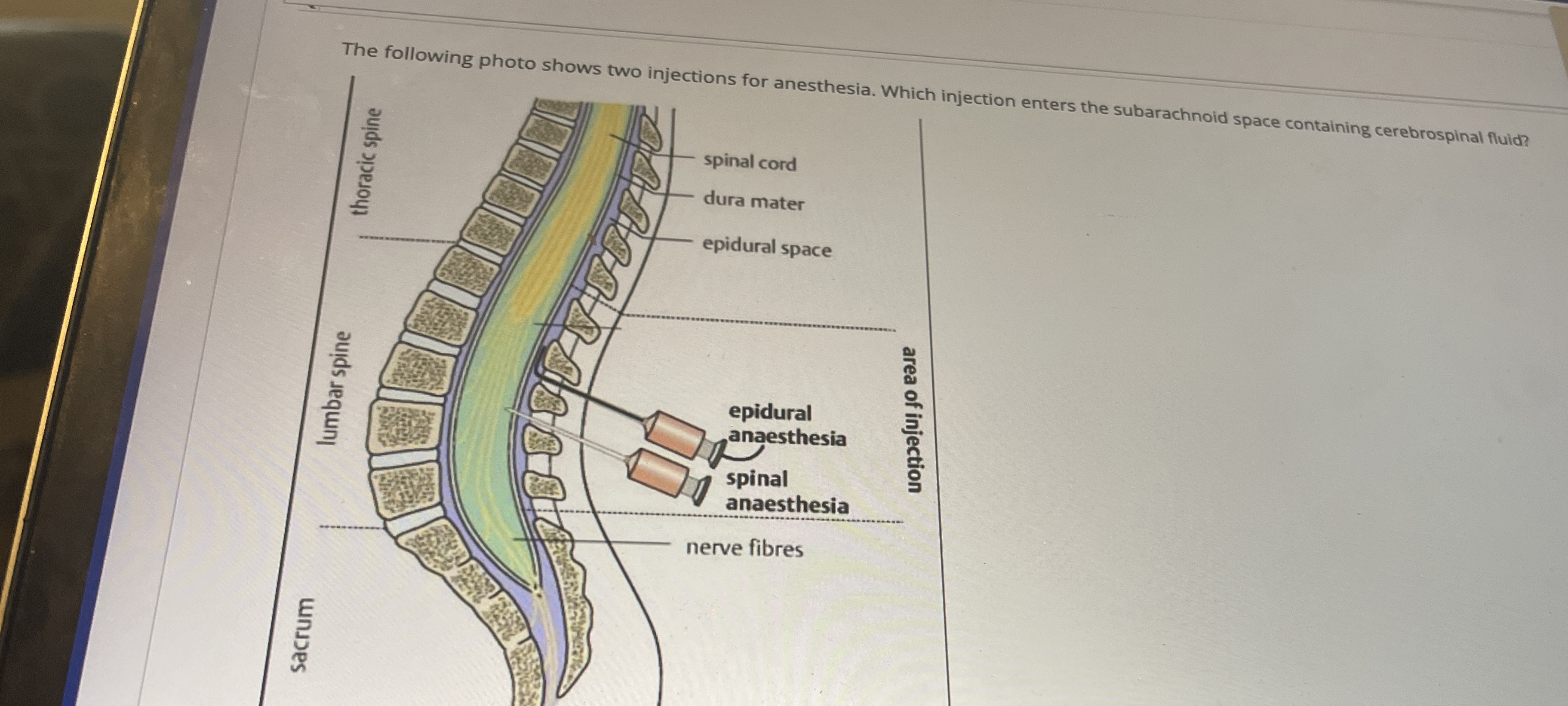Solved The following photo shows two injections for | Chegg.com