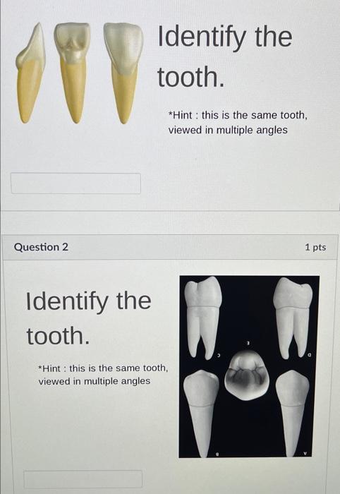 Solved FTT Question 2 Identify the tooth. Identify the | Chegg.com