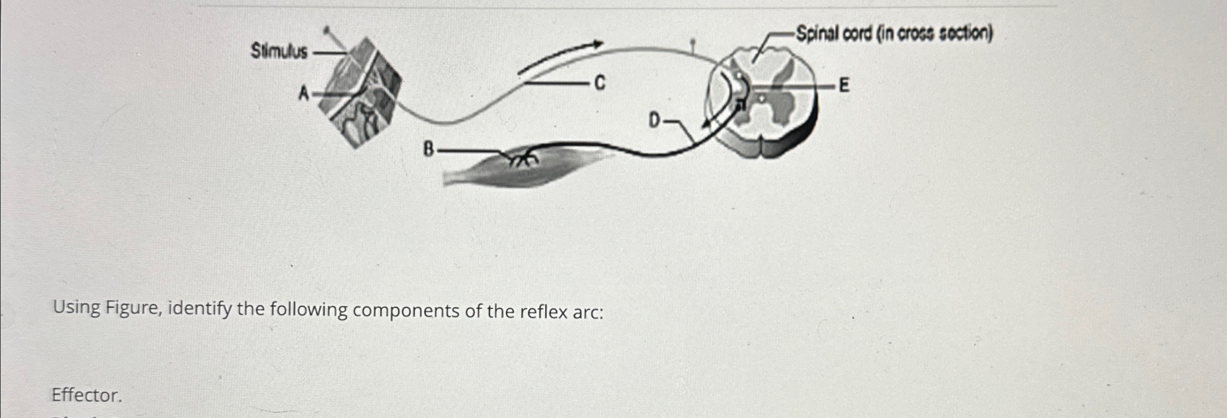 Using Figure, identify the following components of | Chegg.com