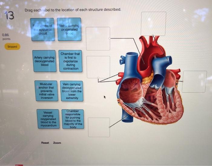 Drag each label to the location of each structure | Chegg.com