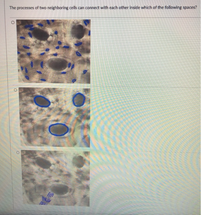 Solved The processes of two neighboring cells can connect | Chegg.com