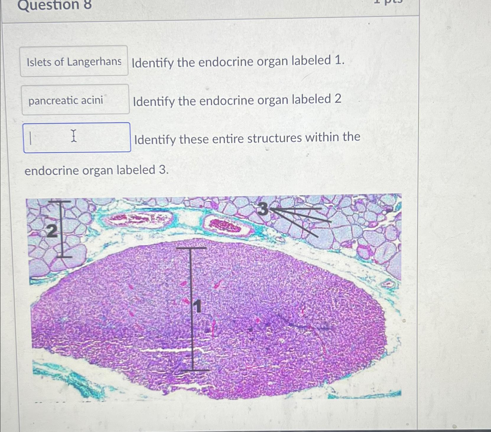 Solved Question 8Identify the endocrine organ labeled | Chegg.com
