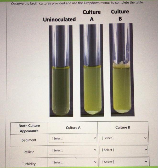 Solved Observe the broth cultures provided and use the | Chegg.com