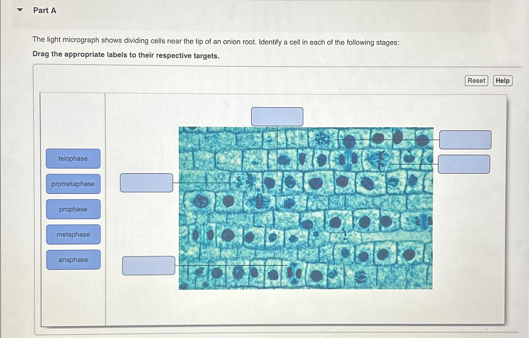 Solved Part AThe light micrograph shows dividing cells near | Chegg.com