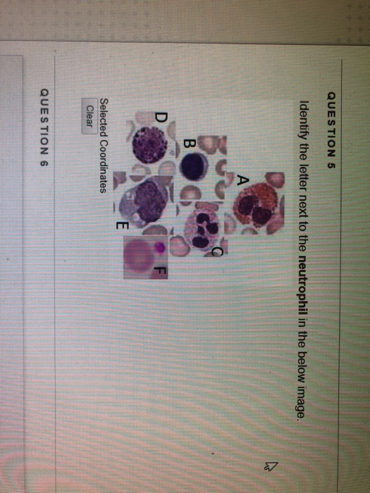 Solved QUESTION 5 Identify the letter next to the neutrophil | Chegg.com