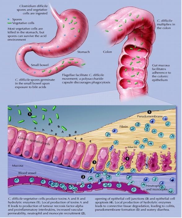 Solved At the end of the case is a picture of the | Chegg.com