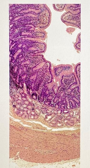 Solved • Mucosa o Intestinal Villi o Simple Columnar | Chegg.com