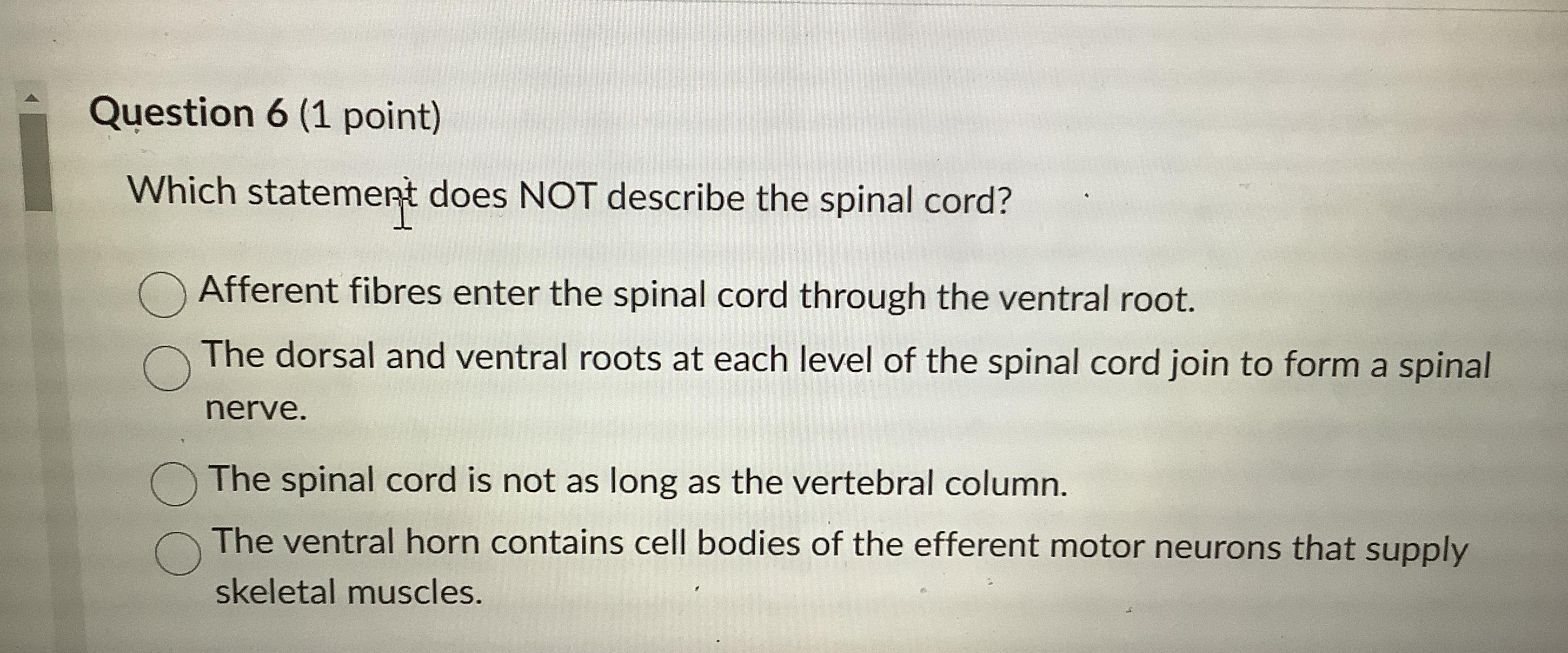 Solved Question 6 (1 ﻿point)Which statement does NOT | Chegg.com
