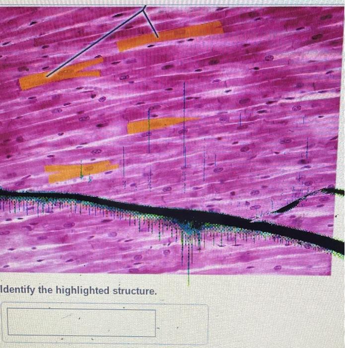 Solved Identify the highlighted structure. | Chegg.com