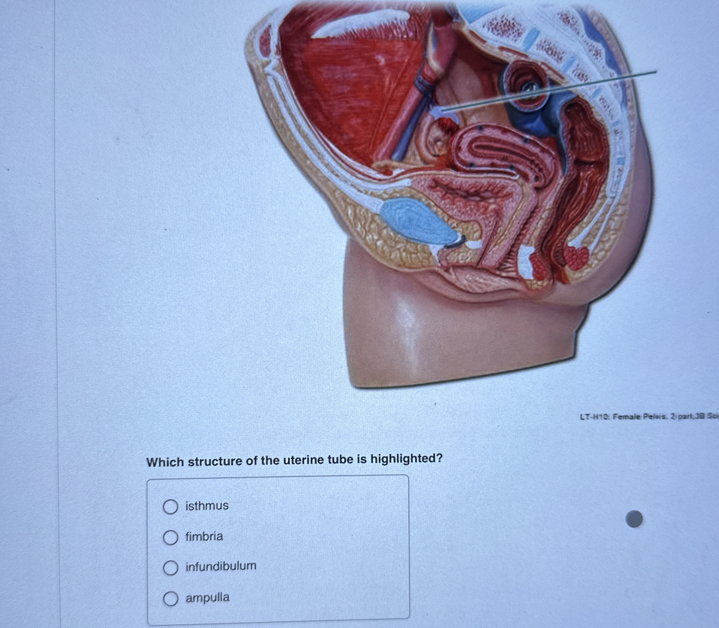 Solved LT-H10: Female Pelvis. 2 ﻿;parti.3B SciWhich | Chegg.com
