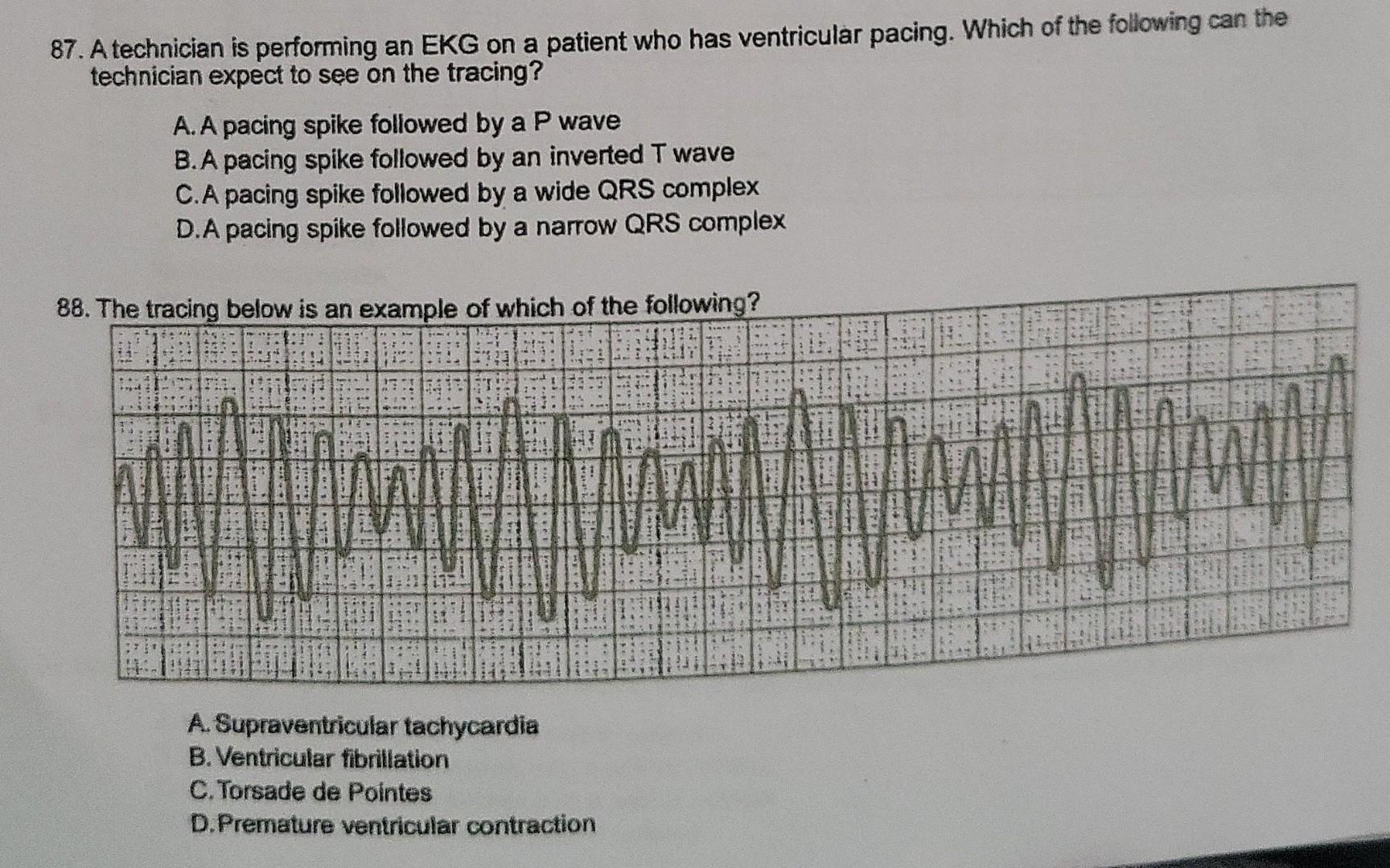 Solved D. Pulse 78. After performing a nonstandard EKG on a | Chegg.com