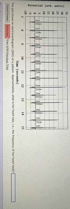 Solved The plot shows an electrocardiogram (EKG) of a | Chegg.com