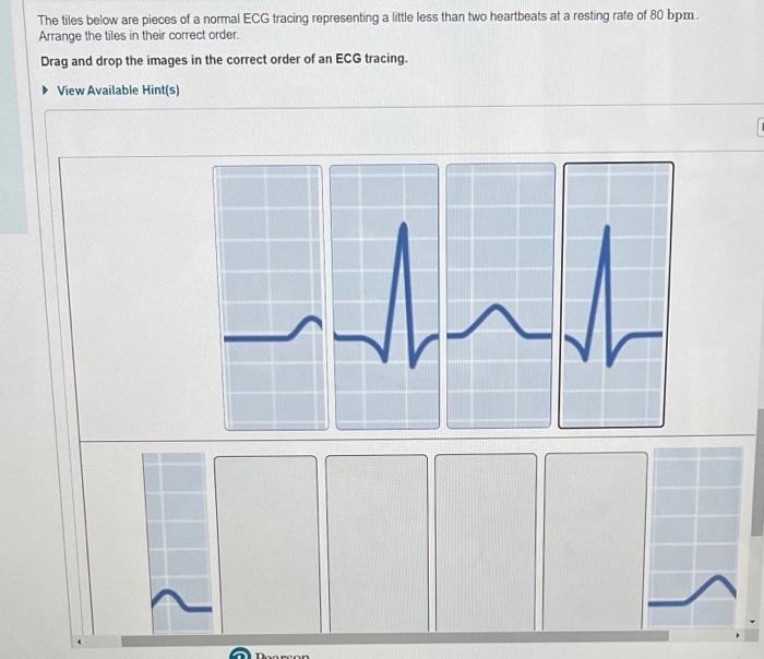 Solved The tiles below are pieces of a normal ECG tracing | Chegg.com