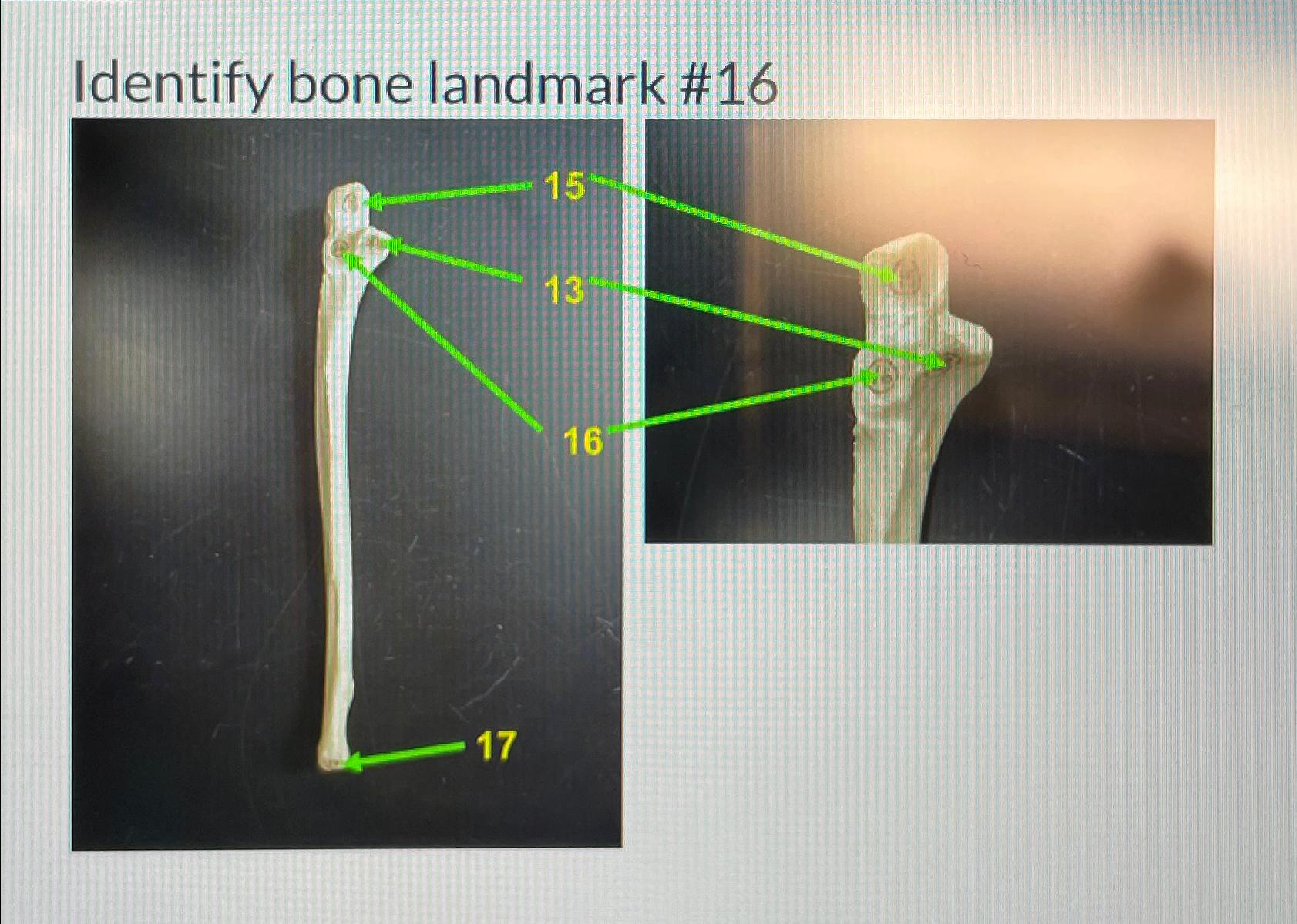 Solved Identify bone landmark #16 | Chegg.com