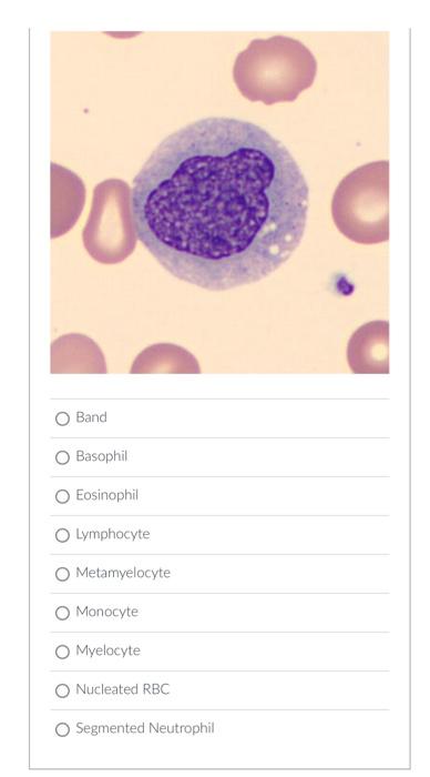 Solved Band Basophil Eosinophil Lymphocyte Monocyte | Chegg.com