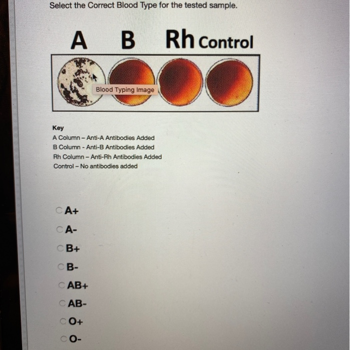 Solved Select the correct Blood Type for the tested sample. | Chegg.com