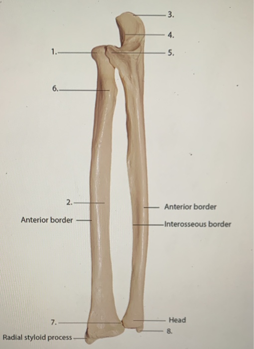 Solved 3. 3. 4. 1. 5. 6. 2. Anterior border Anterior border | Chegg.com